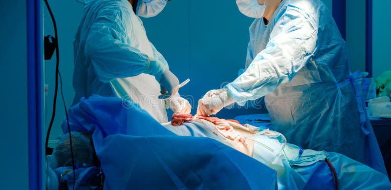 Two Surgeons in Blue Uniforms Operate on a Patient on an Operating ...