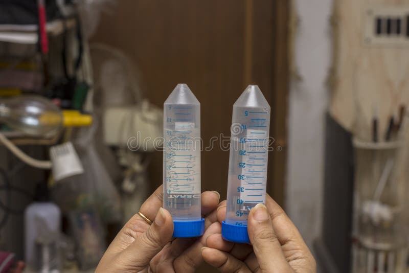 Two Test Tubes for Laboratory Testing Bacteria and Fungus Stock Image ...
