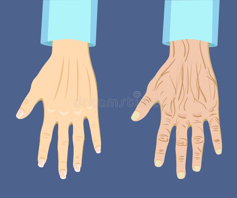 Two Types of Hand , Old and Young, Vector Illustration Stock Vector ...
