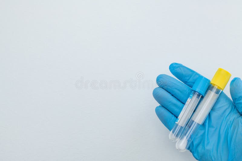 Two Vacuum Tubes for Collection and Blood Samples with Sodium Citrate ...