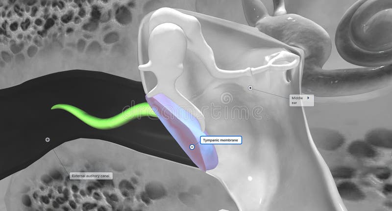 The Tympanic Membrane (eardrum) Separates the External and Middle ...
