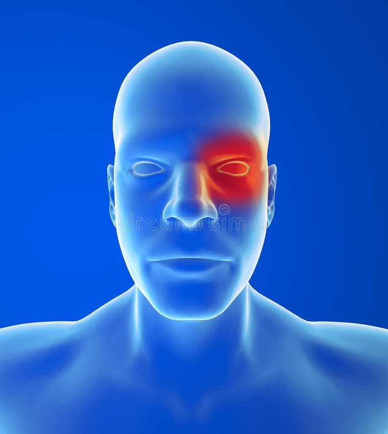Pain Around Eye Stock Illustrations – 30 Pain Around Eye Stock ...