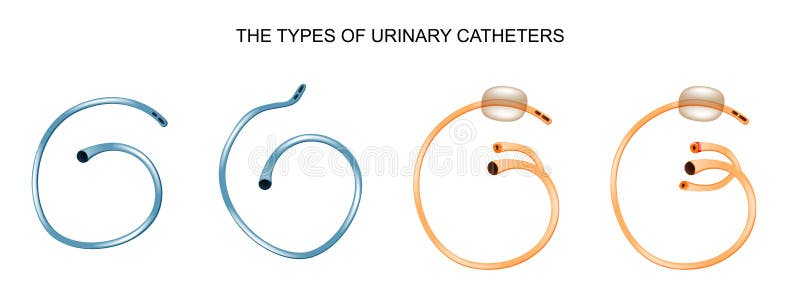 Typerna av urin- kateter vektor illustrationer. Illustration av kirurgi ...