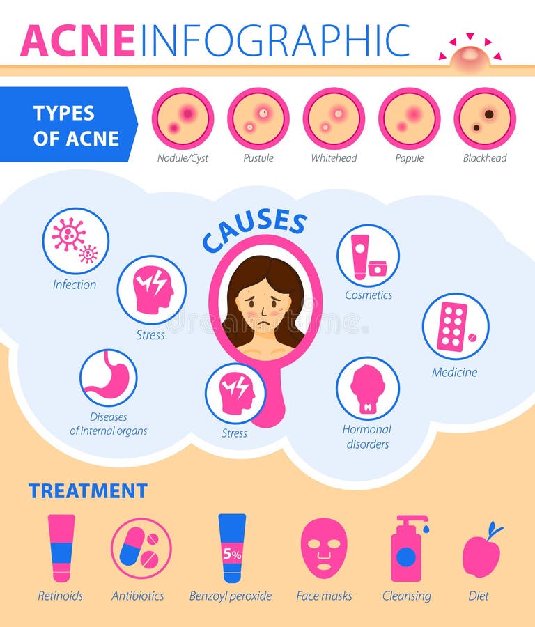 Types of Acne, Causes of the Disease, Treatment. Infographics of Acne ...