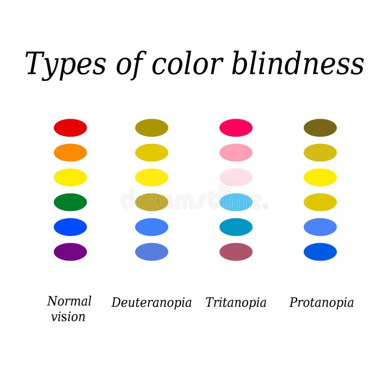 Types of Color Blindness. Eye Color Perception Stock Vector ...