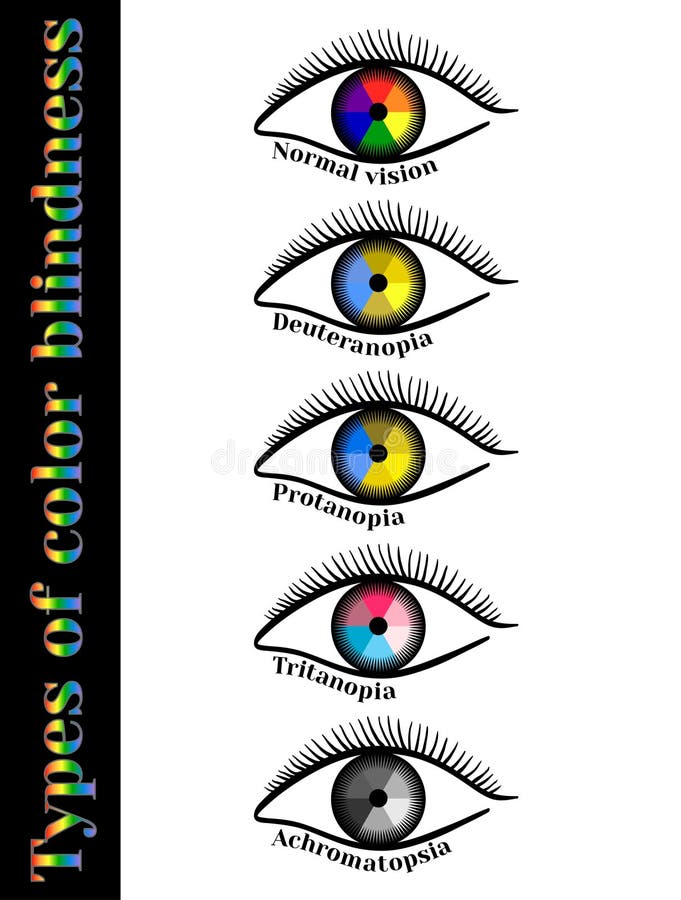 Types of color blindness. stock vector. Illustration of daltonism ...