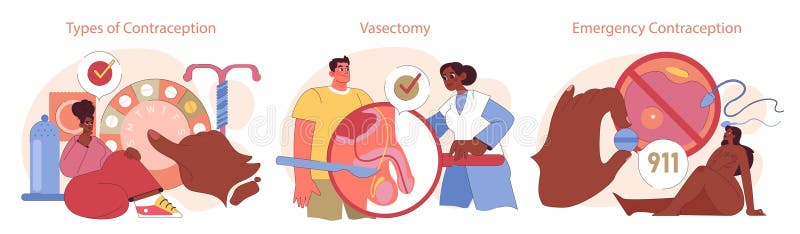 Types of Contraception Set. Insightful Overview of Contraception ...