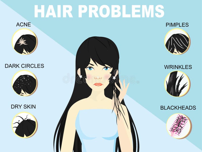 Types of Hair Problem, Alopecia, Damage, Gray Hair Stock Vector ...