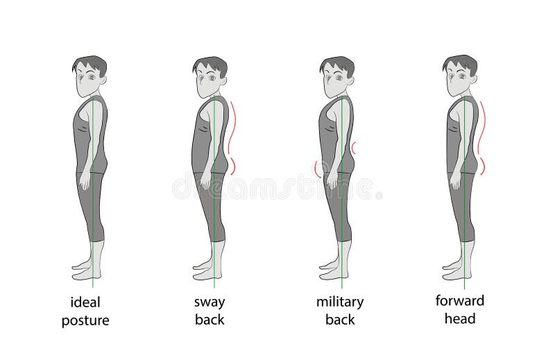 Types of Posture in Men. Vector Illustration Stock Vector ...