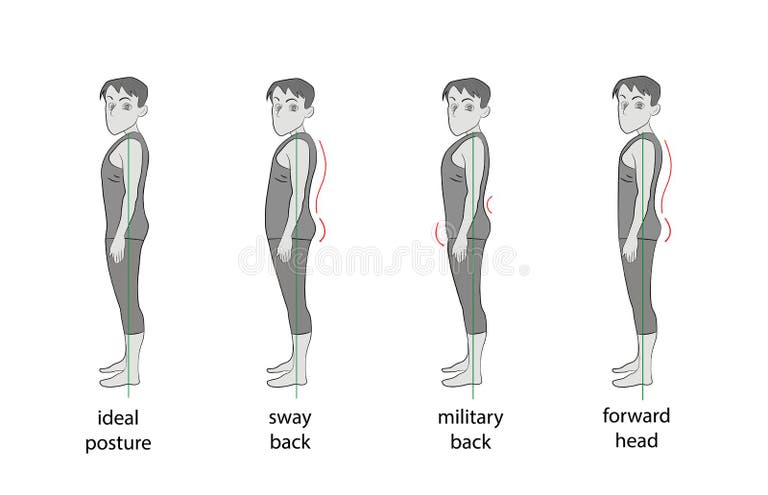 Types Standing Posture Stock Illustrations – 38 Types Standing Posture ...