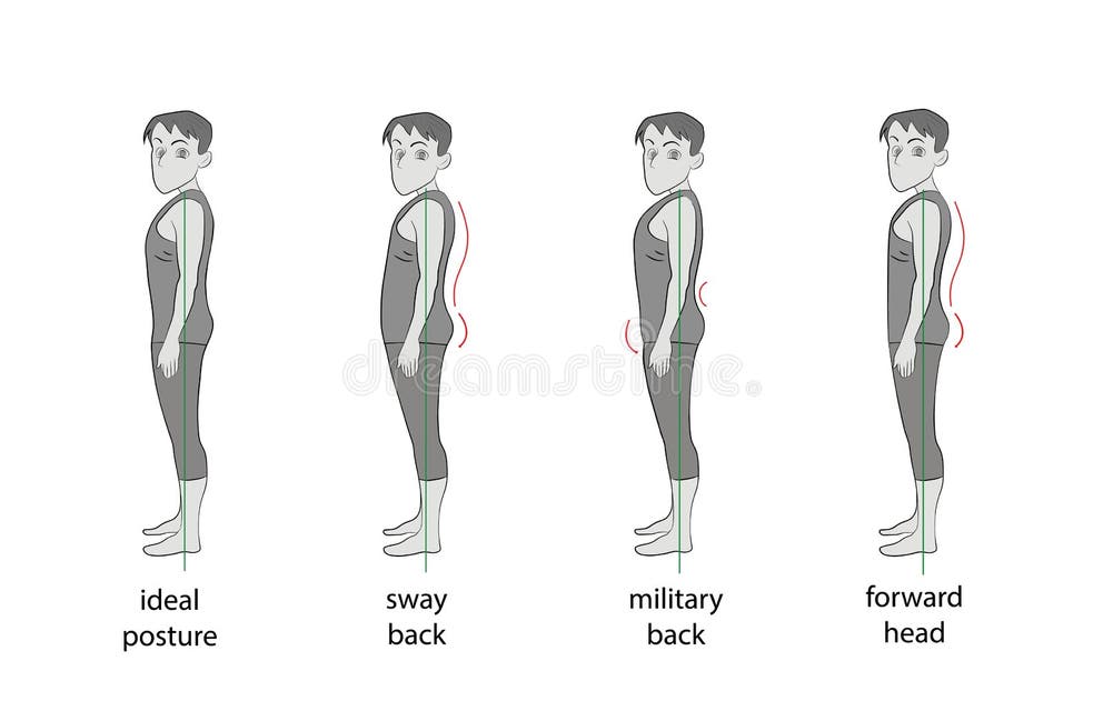 Types of Posture in Men. Vector Illustration Stock Vector ...