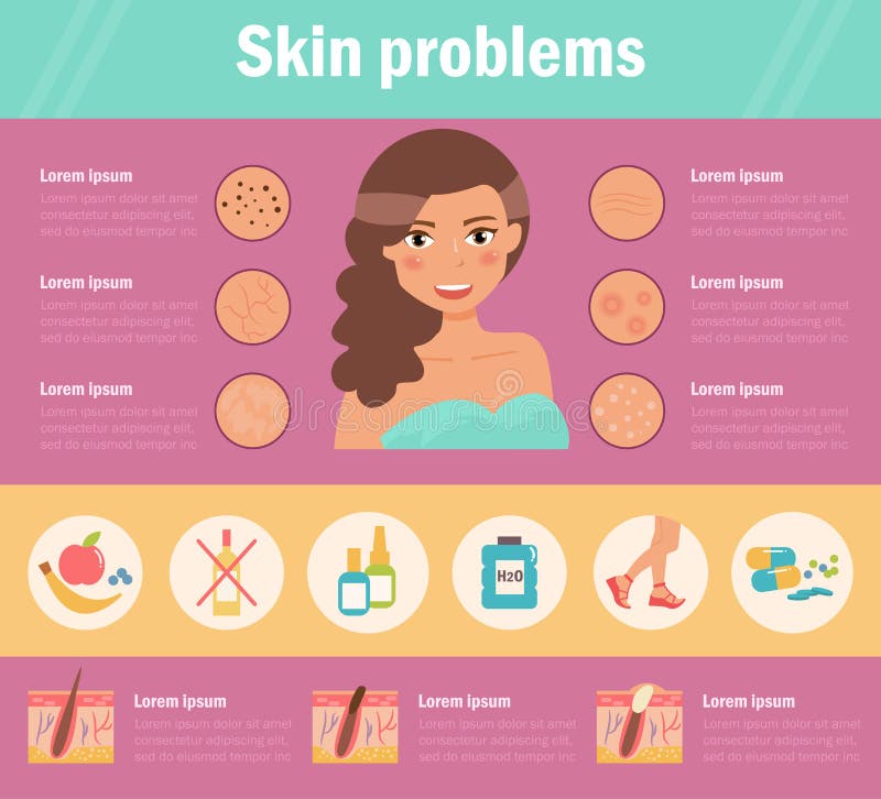 Dry Skin Healthy Skin Cartoon Stock Illustrations – 338 Dry Skin ...