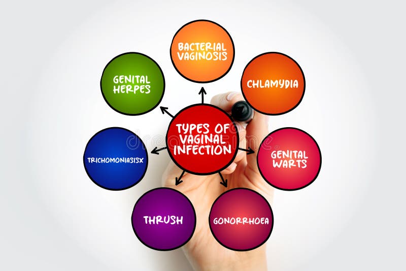 Types of Vaginal Infection Mind Map, Text Concept for Presentations and Reports Stock Image ...