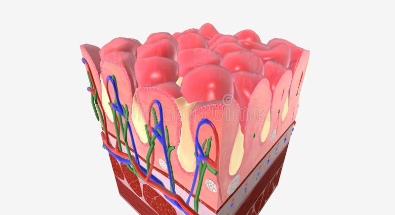 Ulcerative Colitis, Effects on Colon Tissue Stock Illustration ...