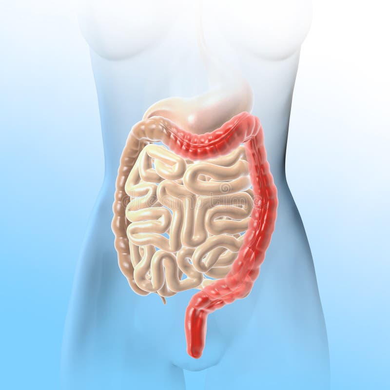 Colitis stock vector. Illustration of infection, intestine - 49144886