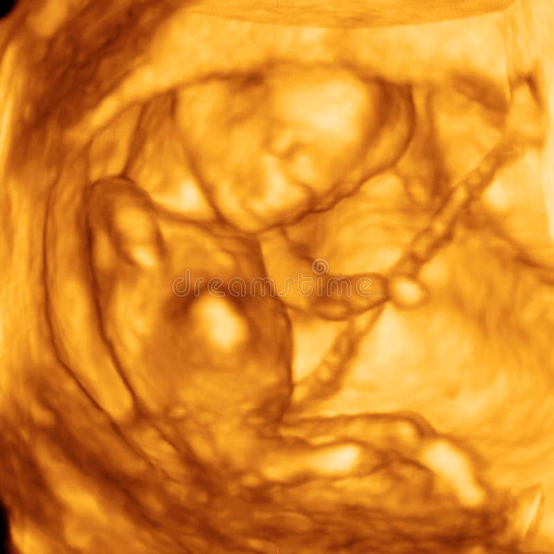 Ultraschall-Baby stockbild. Bild von mutterschaft, pränatal - 33362633
