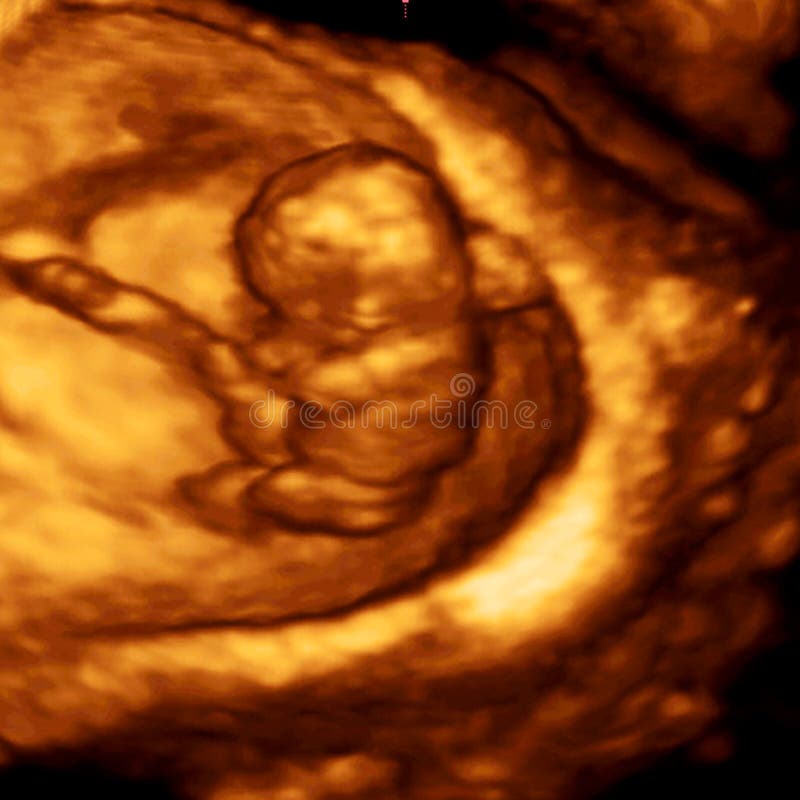 Ultraschall Des Babys In Der Mutter Stockbild - Bild von pränatal ...