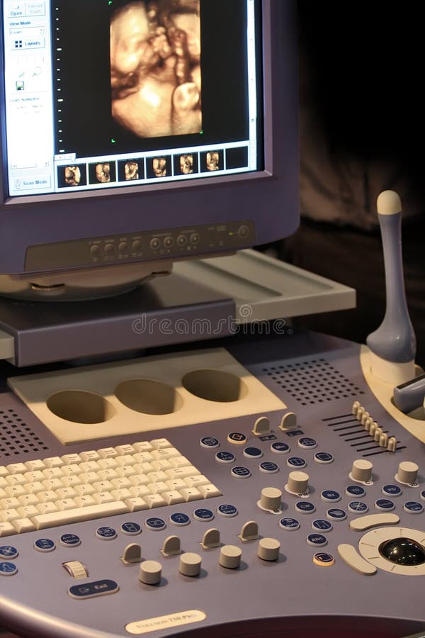Ultrasound medical device stock photo. Image of diagnostic - 20190332