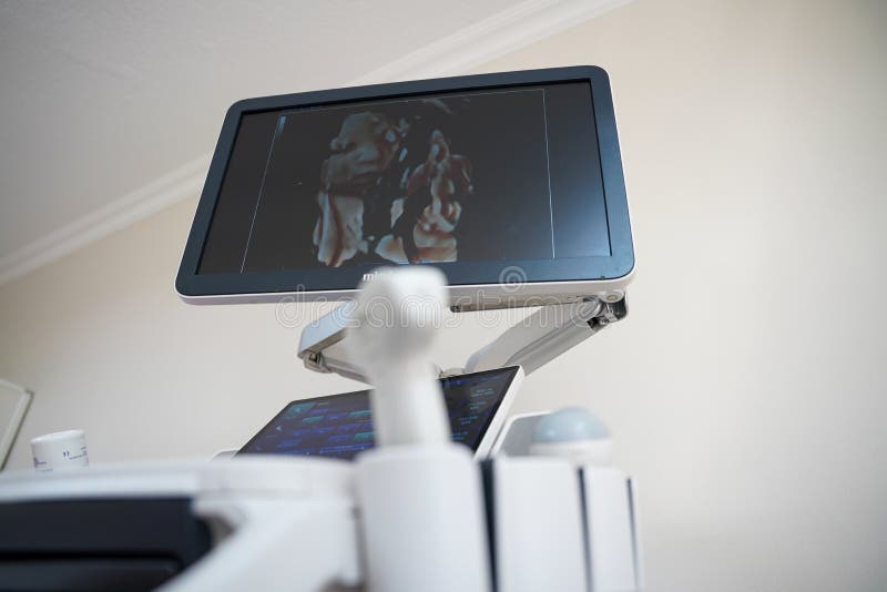 Ultrasound Device and Baby Image on the Screen Stock Photo - Image of ...