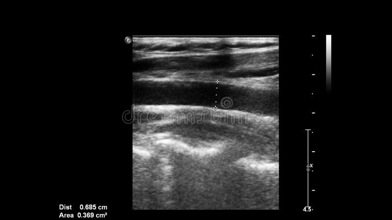 Ultrasound Examination of Blood Vessels. Stock Image - Image of doctor ...