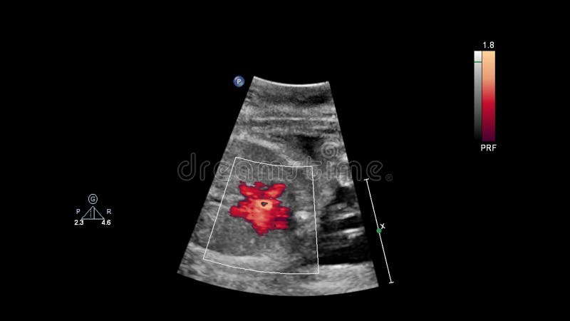 123 Echocardiography Design Stock Photos - Free & Royalty-Free Stock ...