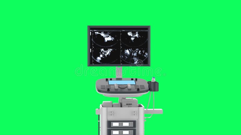 Ultrasound Machine Isolated on Green Screen Video 4k Stock Footage ...