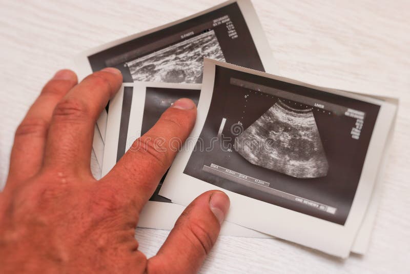 Ultrasound photos stock photo. Image of human, exam, office - 94983382