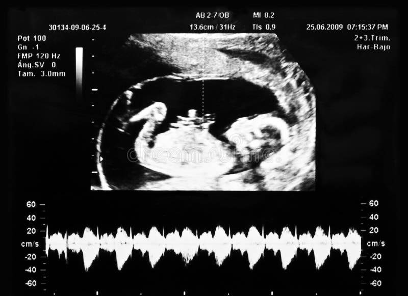 25+ Scan ultrasound Free Stock Photos - StockFreeImages 25+ Scan ultrasound Free Stock Photos - StockFreeImages