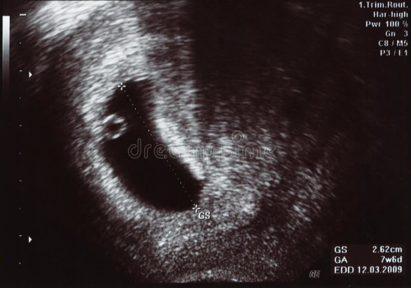 25+ Scan ultrasound Free Stock Photos - StockFreeImages 25+ Scan ultrasound Free Stock Photos - StockFreeImages