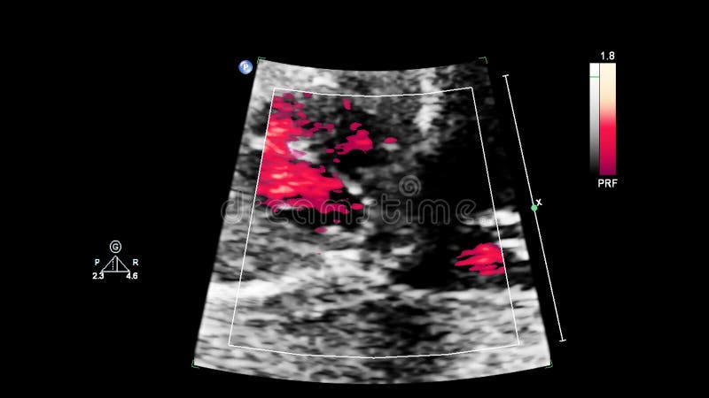 123 Echocardiography Design Stock Photos - Free & Royalty-Free Stock ...
