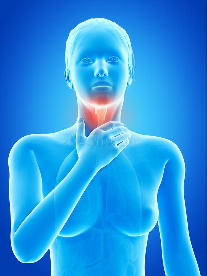 Uma laringe inflamada ilustração stock. Ilustração de interior - 127847894