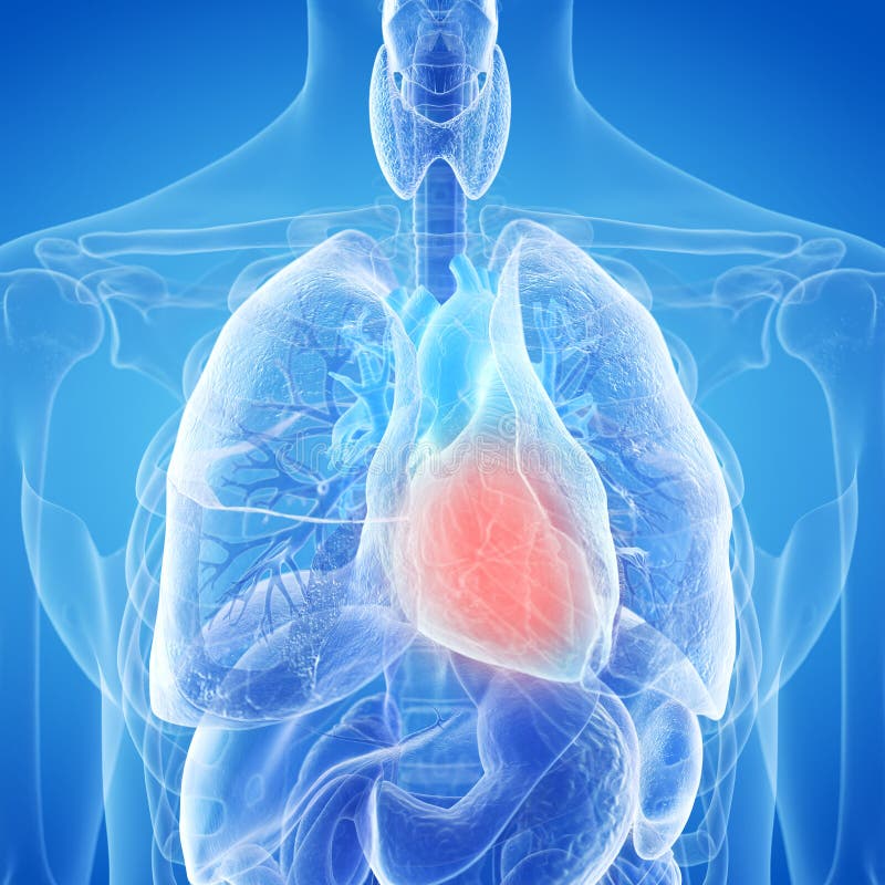 Inflamado Ilustraciones Stock, Vectores, Y Clipart – (7,742 ...