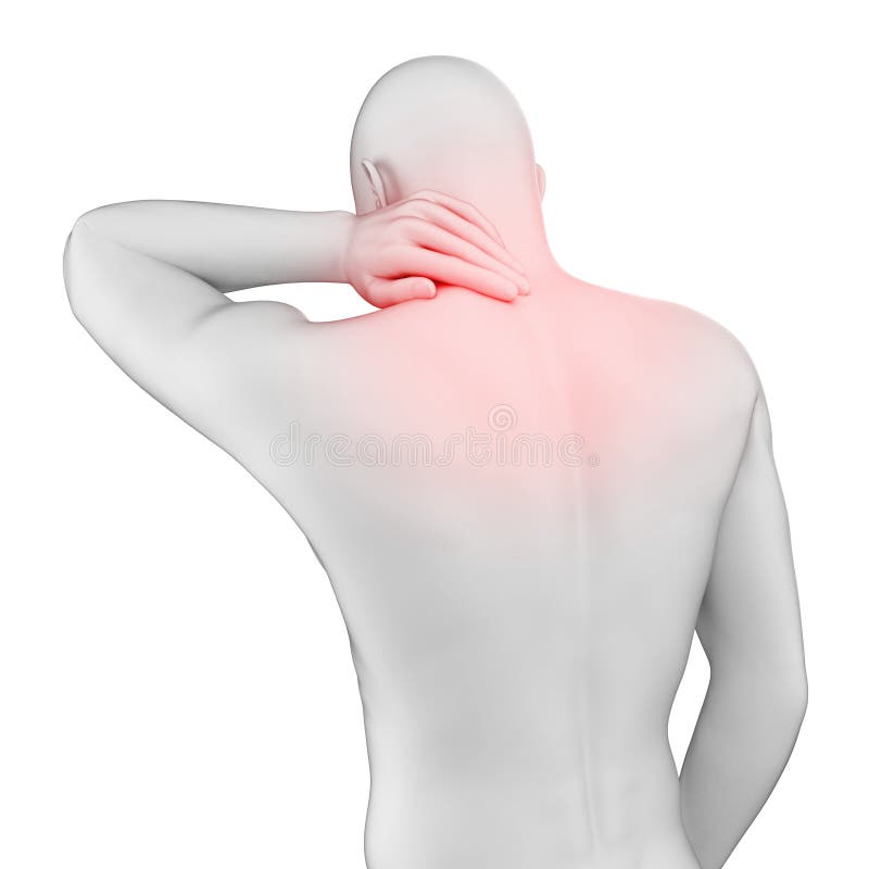 Un cou douloureux illustration stock. Illustration du disease - 74206204