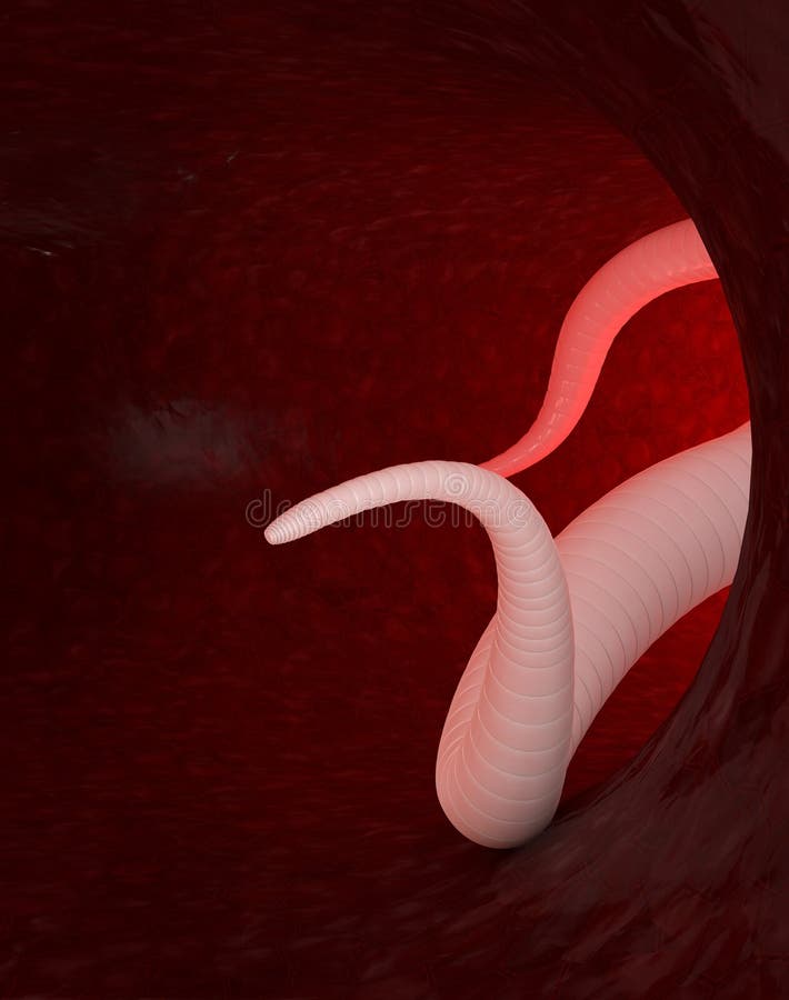 Ascáride, Lombriz Intestinal De Pinworm Del Helminto Fije De Parásito ...