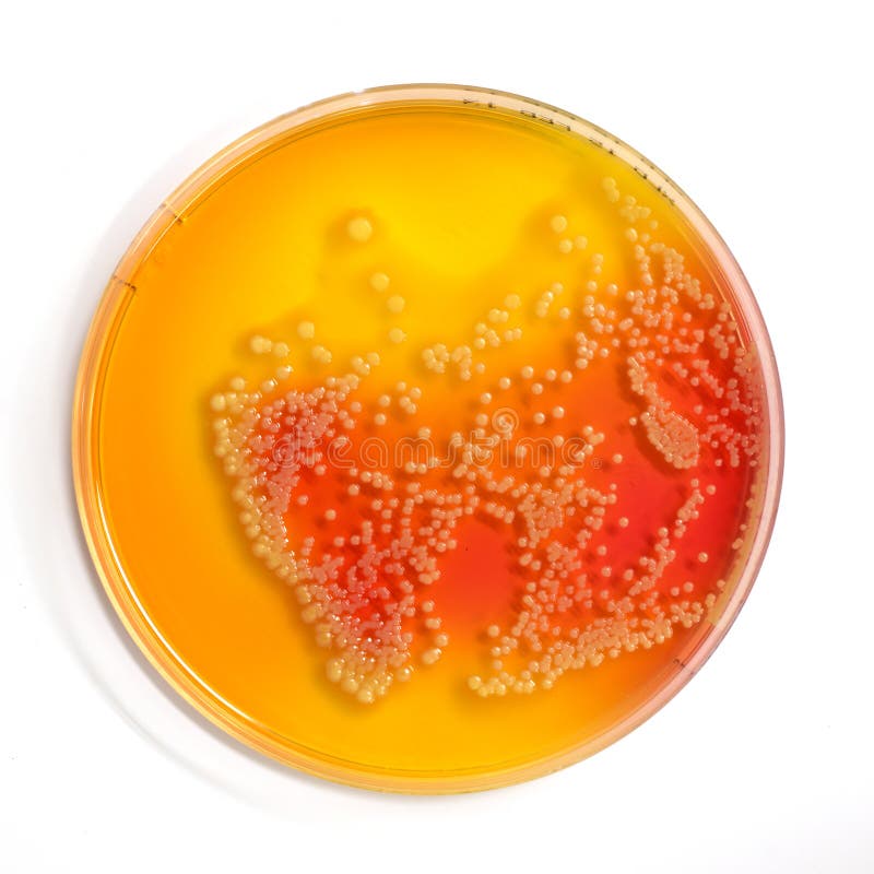 Micro-organismes De Champignons De Plat D'agar Dans Le Laboratoire ...