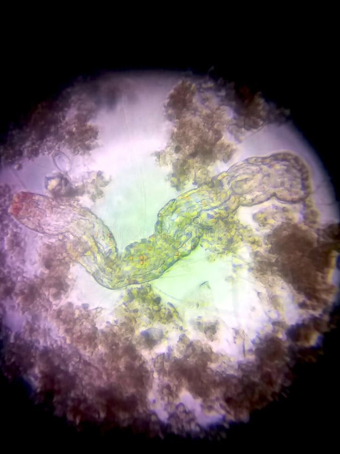 595 Parasites Under Microscope Stock Photos - Free & Royalty-Free Stock ...