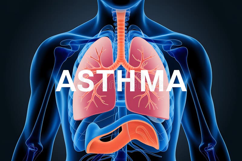 Understanding Asthma: a Visual Representation of the Respiratory System ...