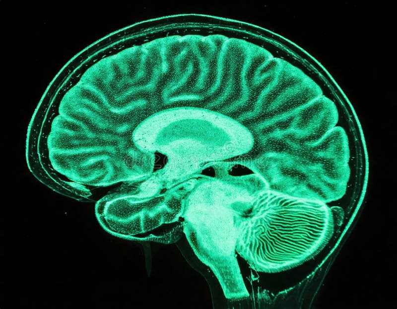 Understanding Brain Tomography Structure through Detailed Imaging ...