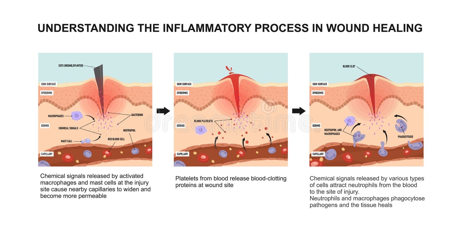 Granulation Process Stock Illustrations – 20 Granulation Process Stock ...