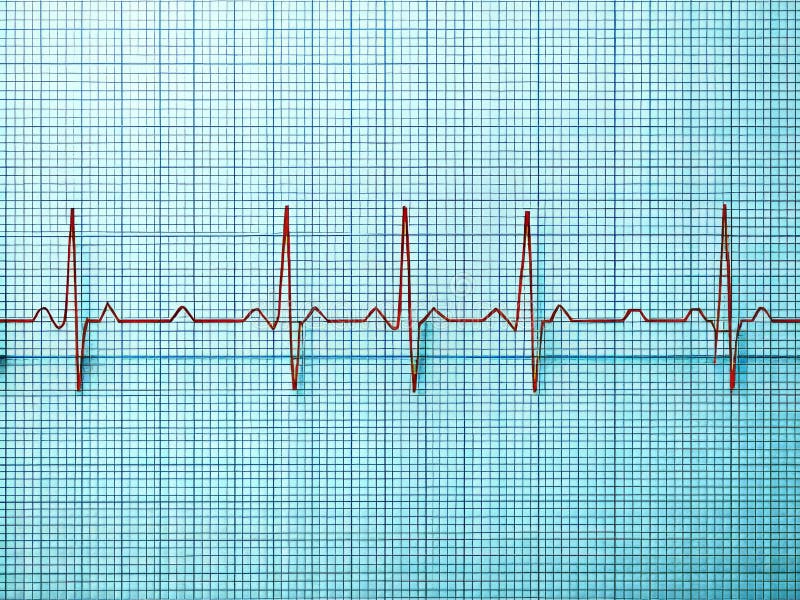 Pacing Intervals Stock Illustrations – 4 Pacing Intervals Stock ...