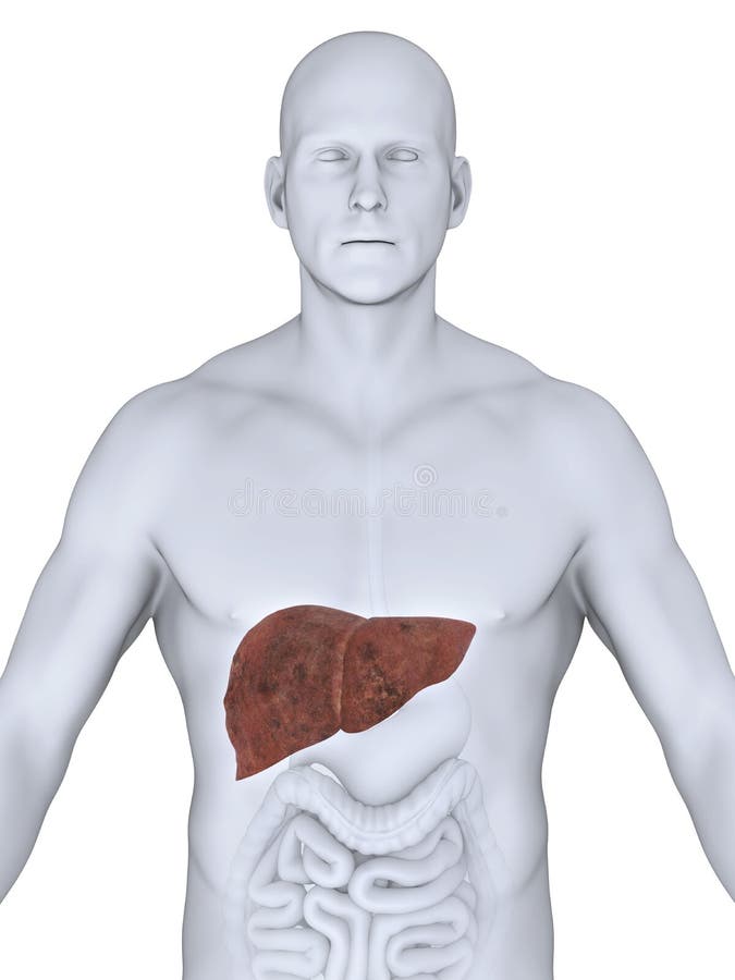 Unhealthy Liver Anatomy stock illustration. Illustration of ileum ...