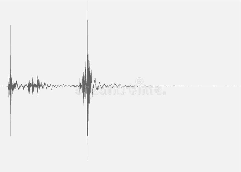 Royalty-Free Unis TBM De Luxe Typewriter Backspace Button 1 Stock Audio ...