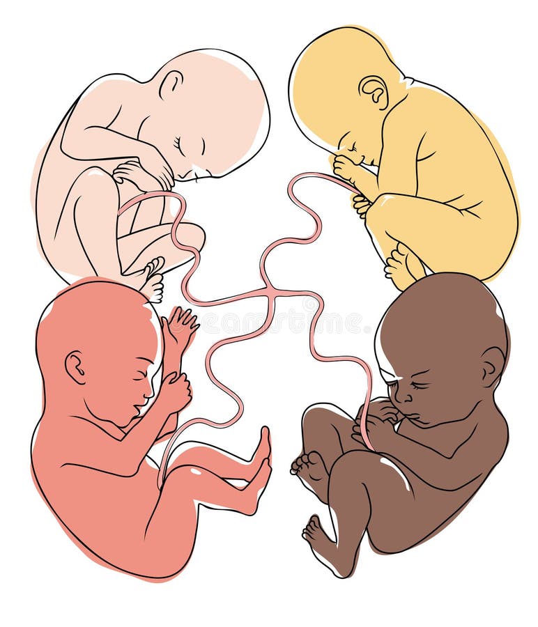 Umbilical Stock Illustrations – 2,358 Umbilical Stock Illustrations ...