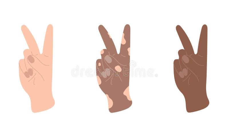 Universal Hand Gesture of Peace. Hand Drawn Vector Illustration in Flat ...