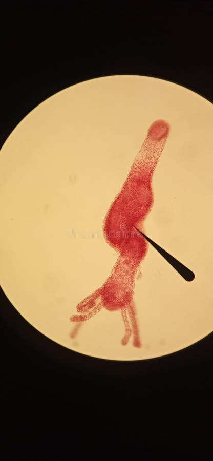 Hydra Microscope View Stock Photos - Free & Royalty-Free Stock Photos ...