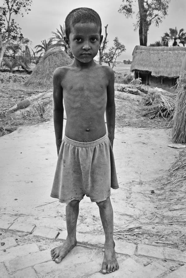 Mangelernährte Kinder in Indien Redaktionelles Stockfotografie - Bild ...
