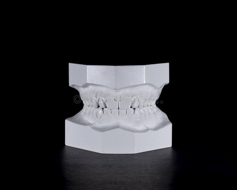 Upper and Lower Dental Models Stock Image - Image of lower, teeth ...