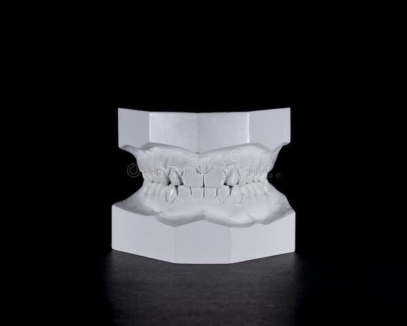 Upper and Lower Dental Models Stock Image - Image of lower, teeth ...