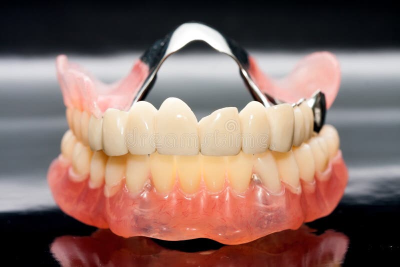 Dental prosthesis stock image. Image of oral, teeth, care - 35646705