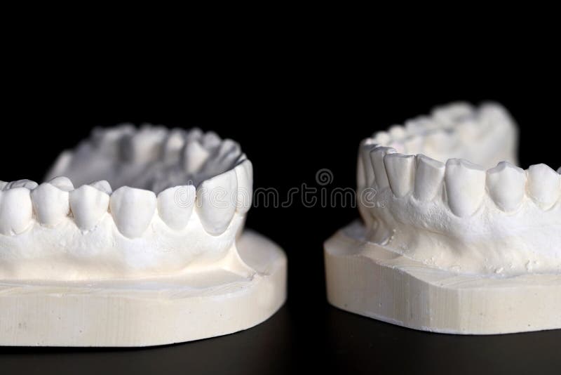 Upper and Lower Teeth Made of Plaster Stock Photo - Image of teeth ...